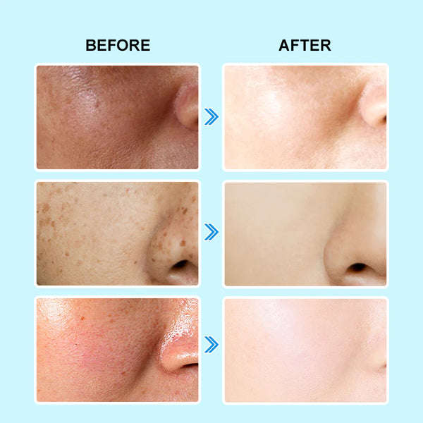 Jelly Prim 3 In 1 Oil-Control And Brightening Serum – Doruk